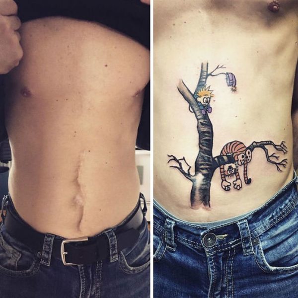 Clever tattoo designs that turn scars into beautiful works of art